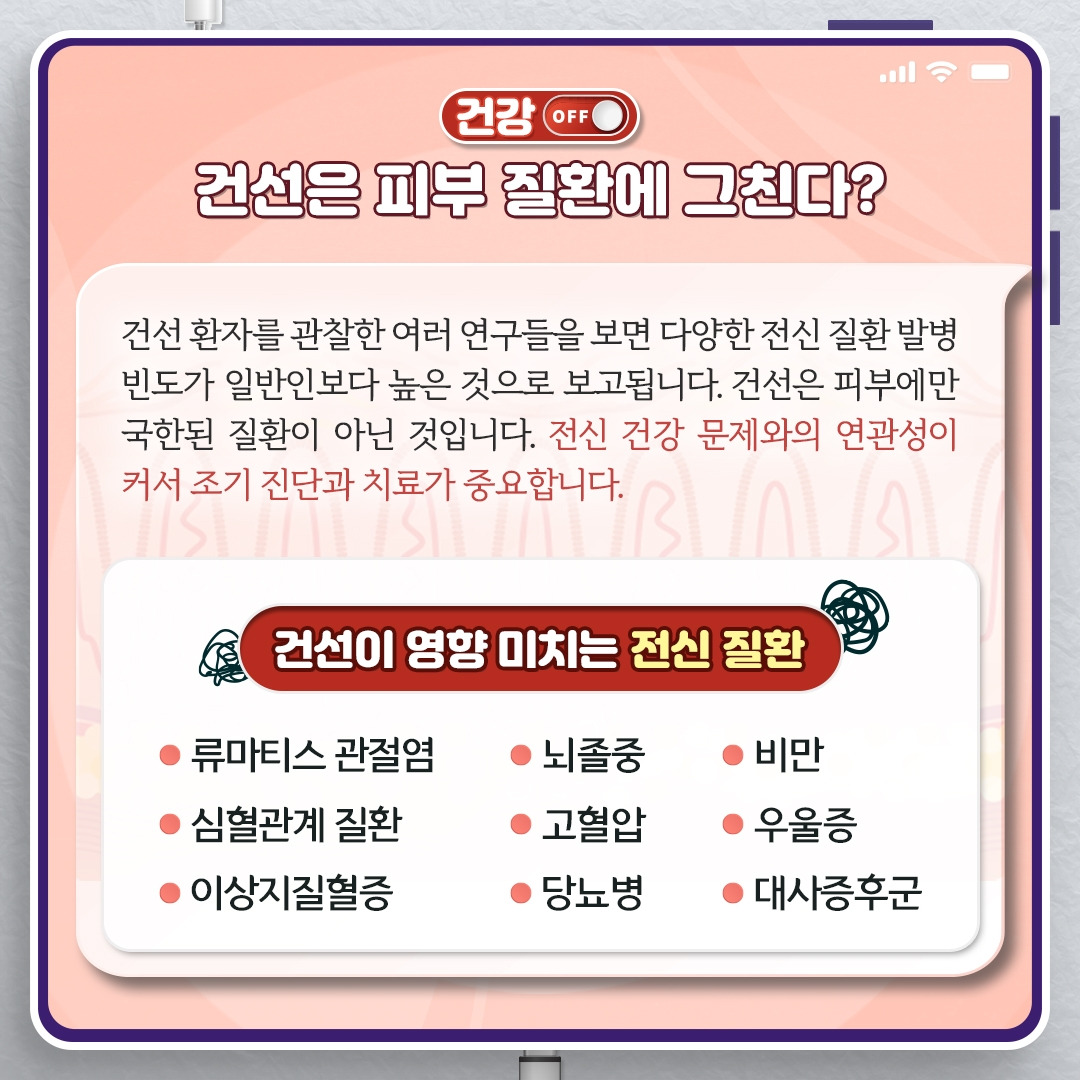 ‘건선은 피부 질환이다