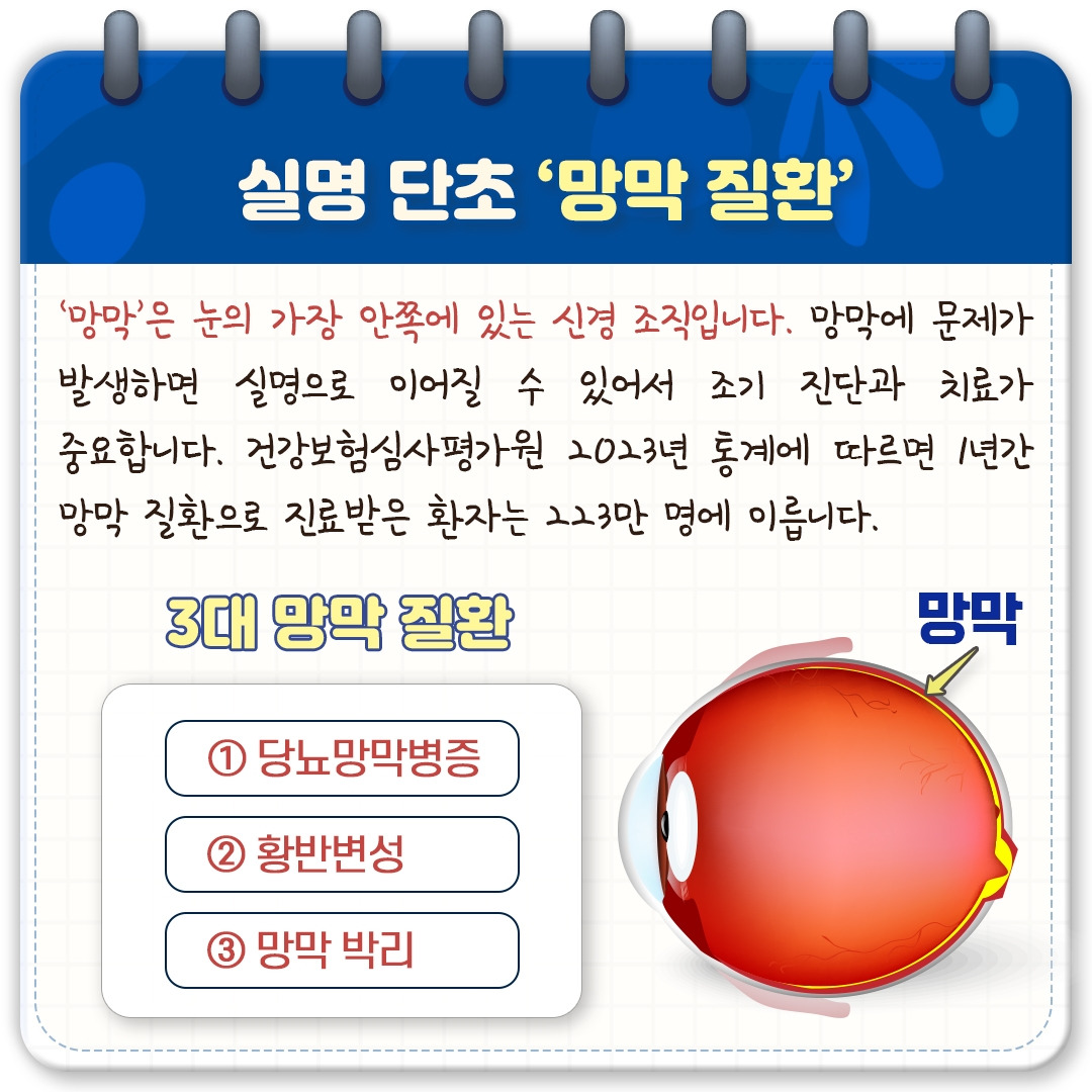 눈에 찾아오는 ‘망막 질환 3가지