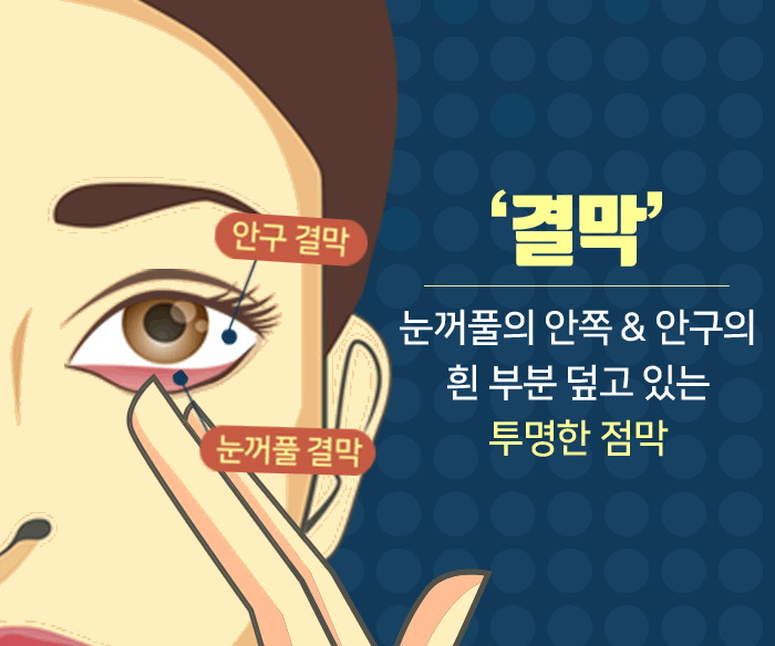 단순한 눈 불편감에 그치지 않아요