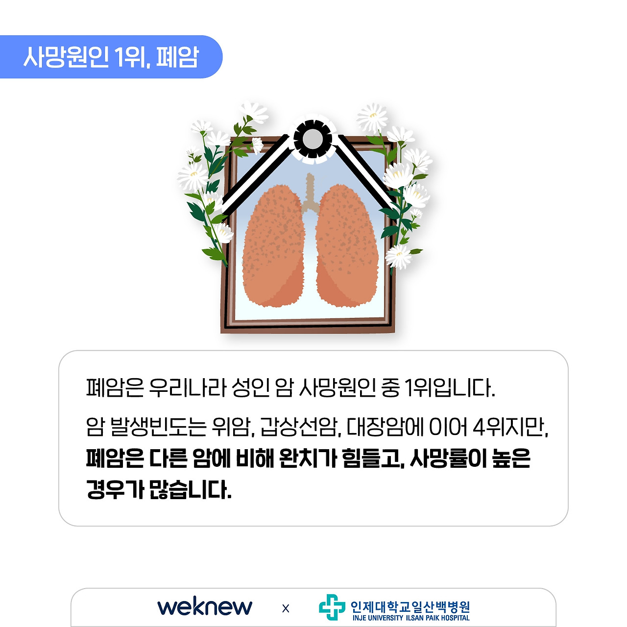 폐암 의심 증상