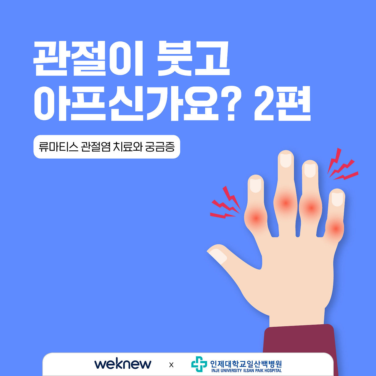 류마티스관절염 증상과 대처방법