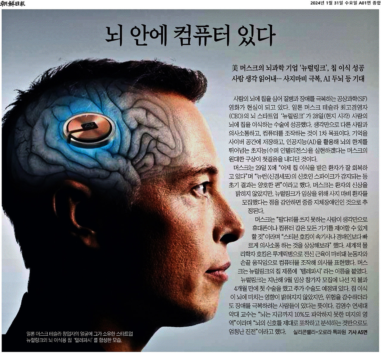 머스크 뇌에 칩이식 성공