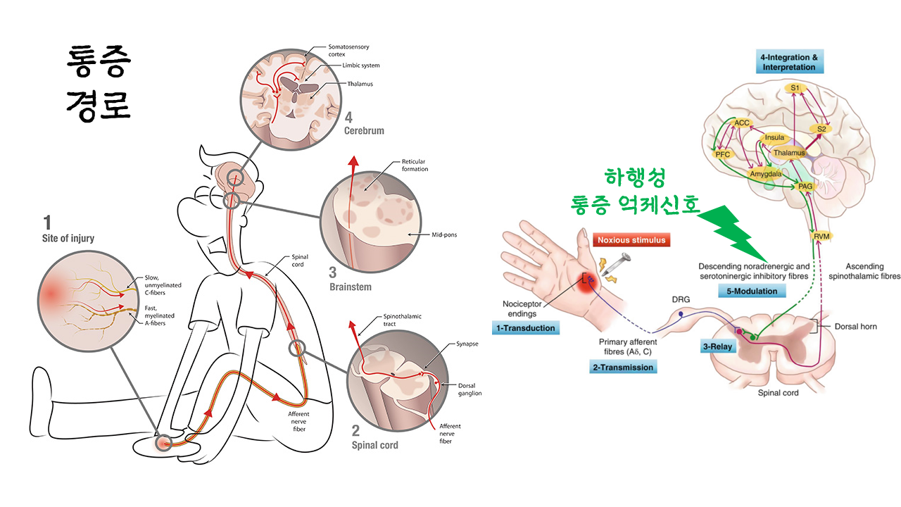 통증 현대인의 치명적인 감정