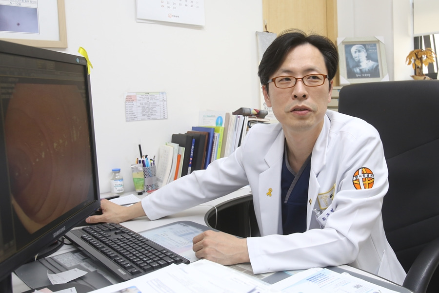 대장내시경 Esd내시경점막하박리술 조기 대장암 치료
