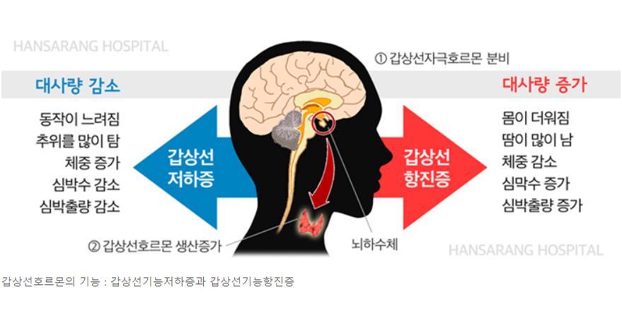 갑상선호르몬 수치와 검사 결과지 보는 법