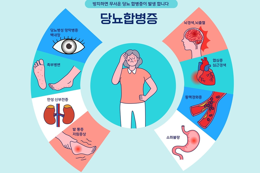 혈관이 돌출 여러 가지 하지정맥류 초기 증상