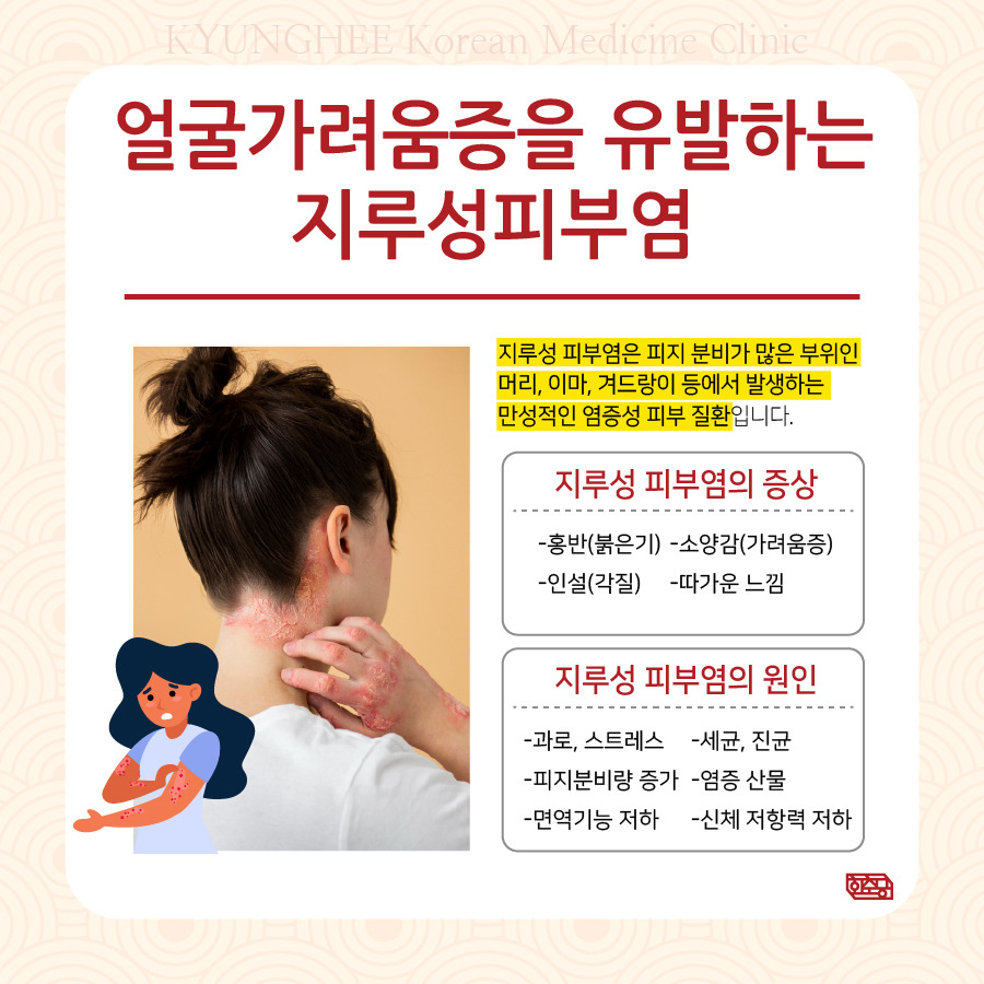 얼굴가려움증 지루성피부염 한방요법으로 해결하세요