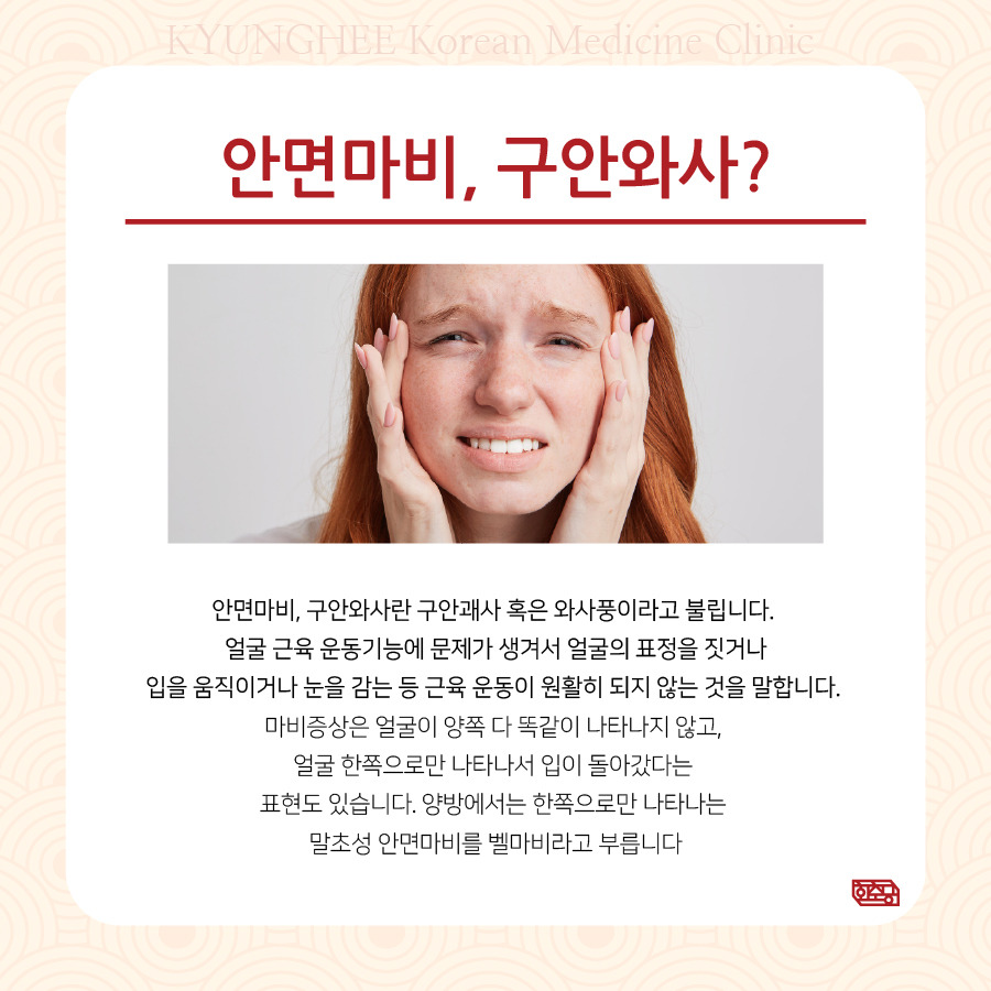 구안와사 치료기간은 얼마나 걸리나요