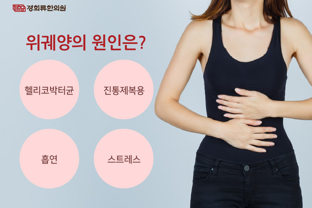 위궤양재발 큰병으로 번지지 않으려면