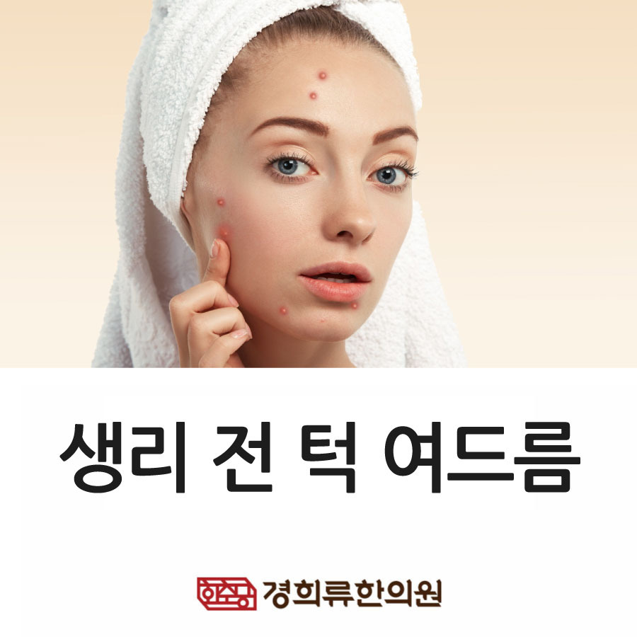 생리전 여드름이 나는 이유는