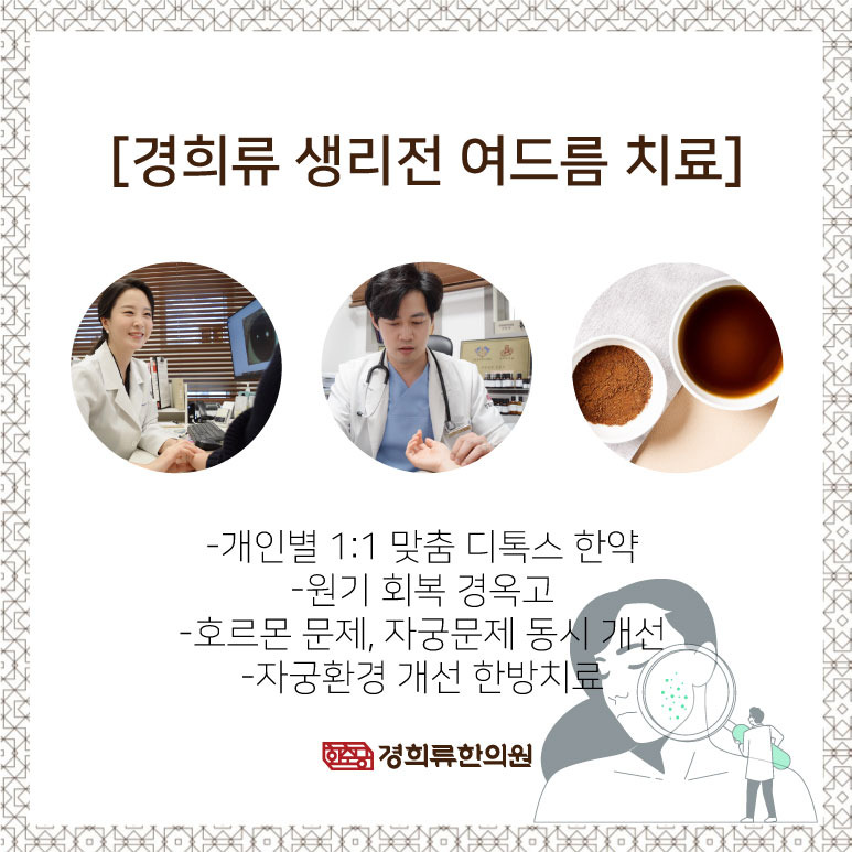 생리전 여드름이 나는 이유는
