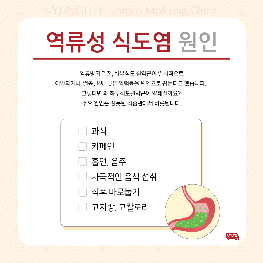역류성 식도염 가래 증상 왜 나타날까