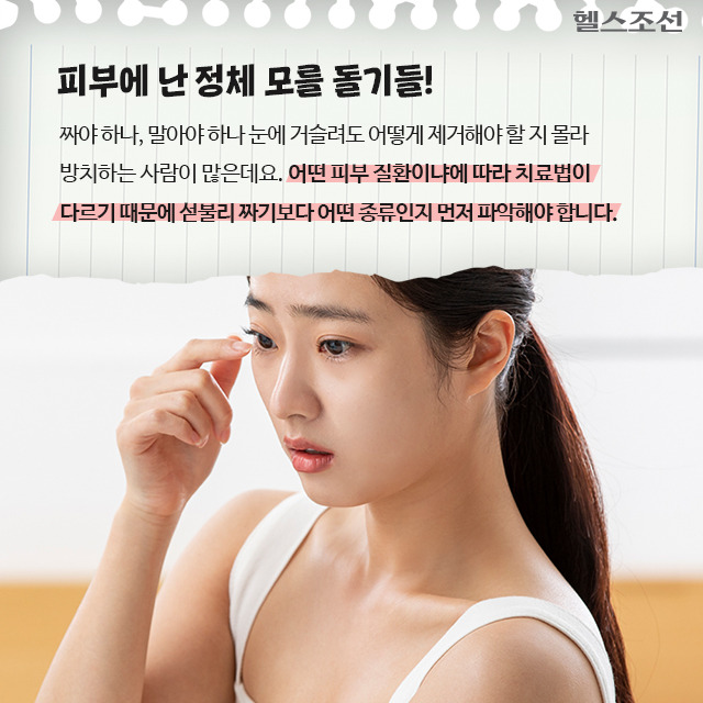 카드뉴스 ‘오돌토돌 눈가 돌기 정체가 뭘까