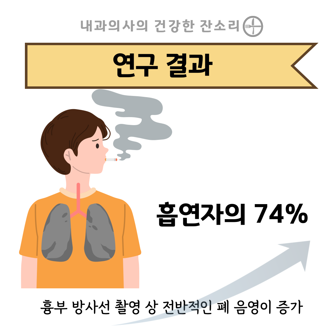 흉부 엑스레이 사진 예쁘게 찍는 법