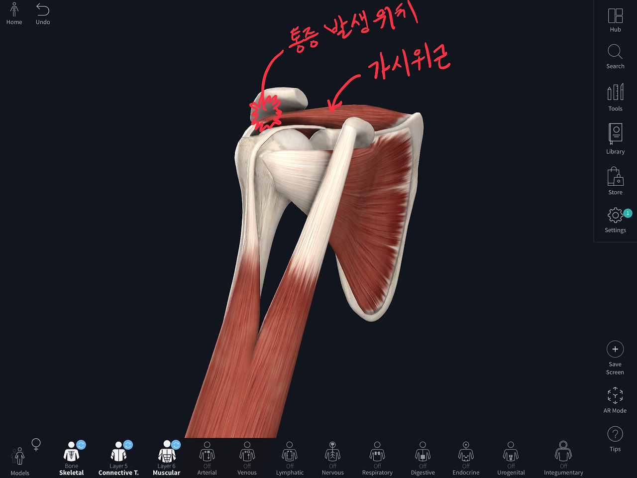 어깨뼈날개뼈의 위쪽 돌림상방회전이 중요한 이유2