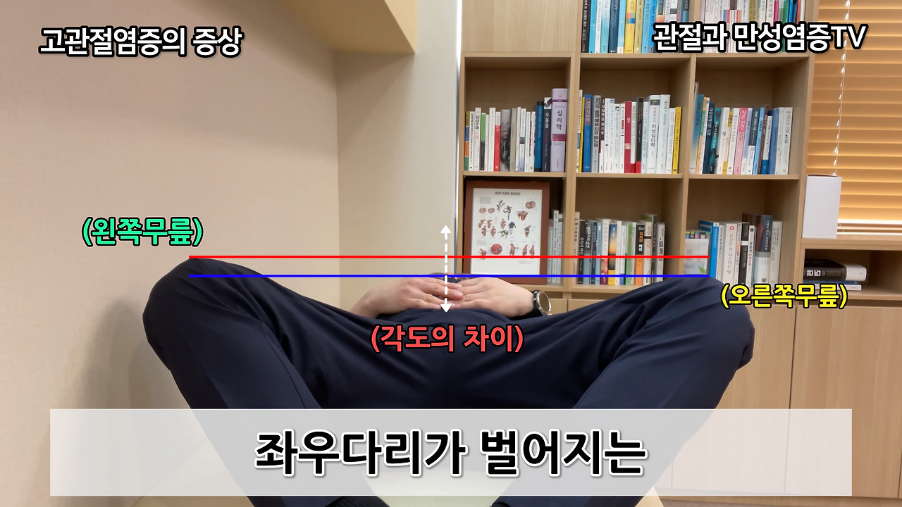 고관절 소리 통증 없애는 스트레칭