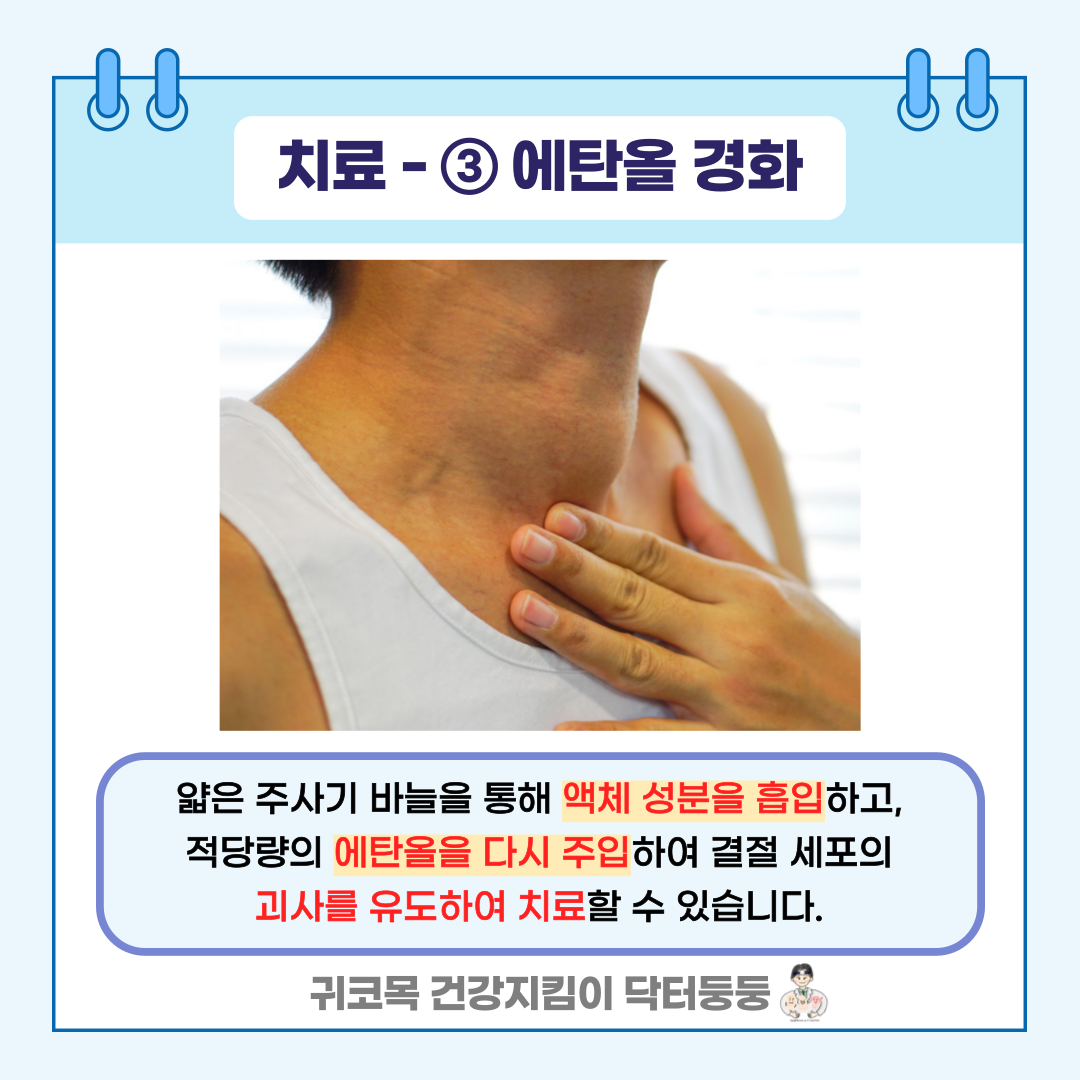 갑상선 낭종 갑상선 물혹