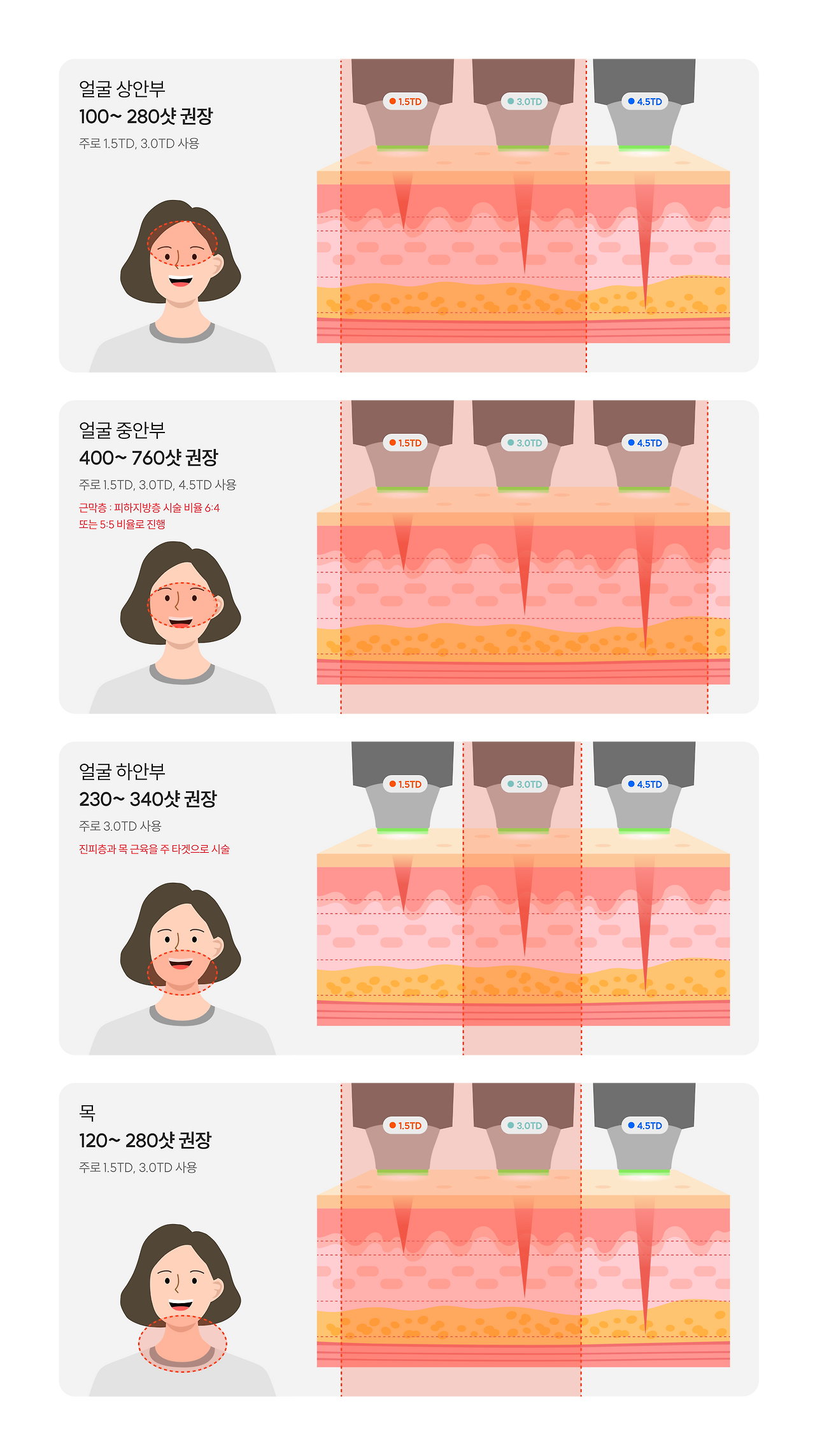 V라인 리프팅 울쎄라 Vs 써마지 어떤 게 나을까