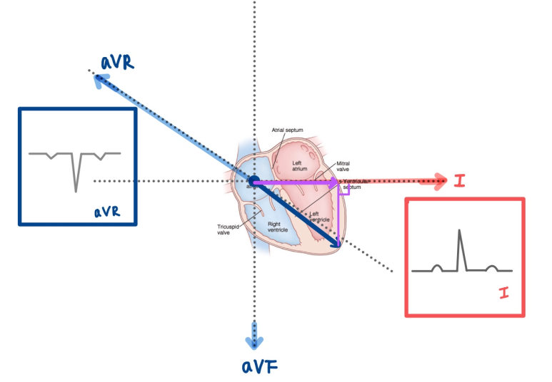 Ecg 기초정리 1 심전도 기초설명 심전도의 원리 사지유도 정상심전도