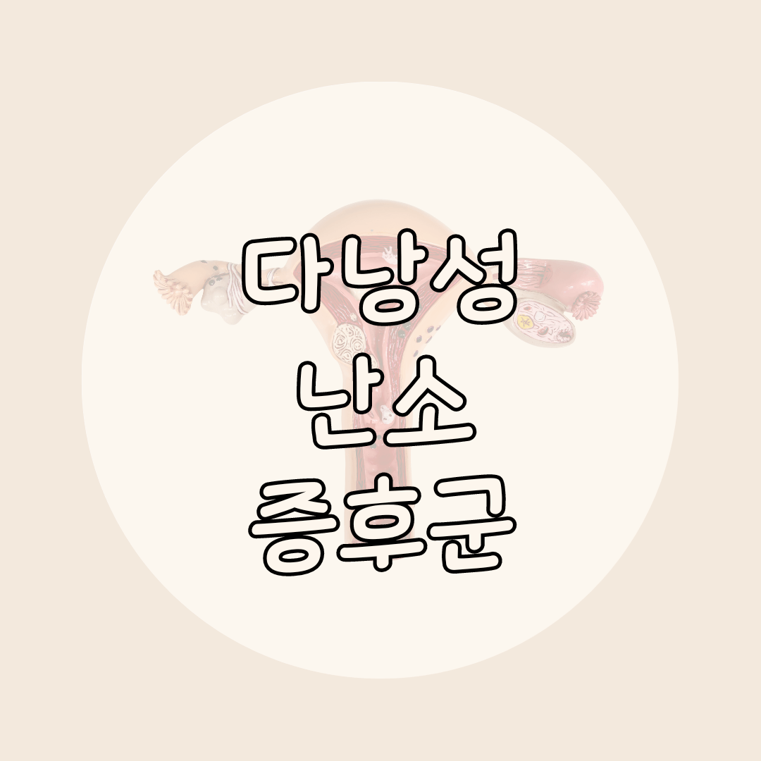 다낭성 난소 증후군 증상 치료 예방하는 방법