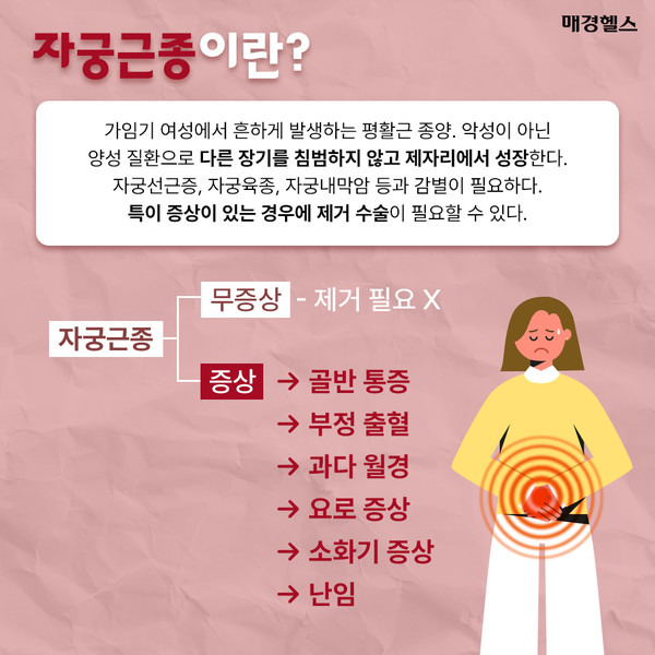 자궁근종 증상 자궁근종 치료 원인