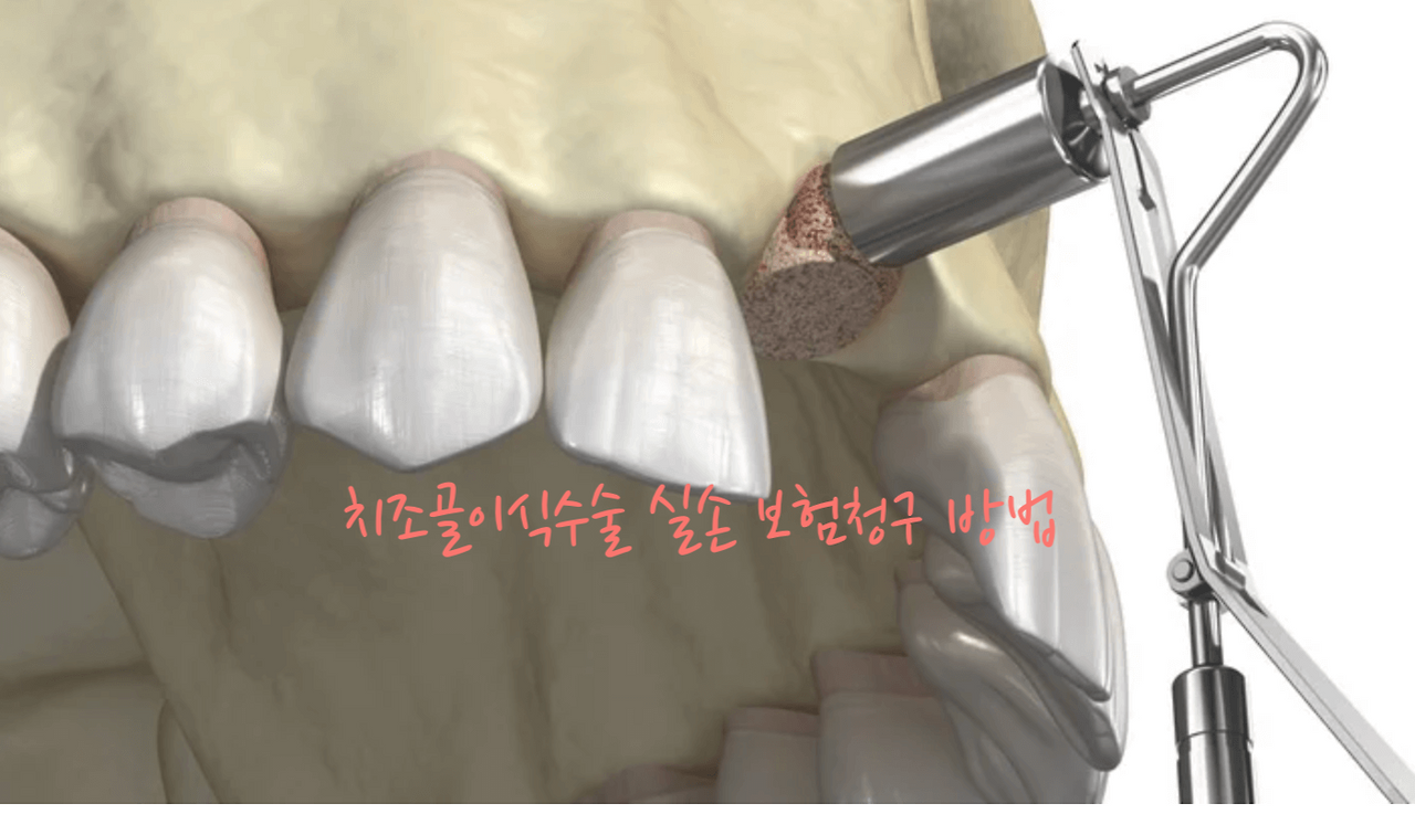 치조골이식수술 실비 보험 청구 방법 후기