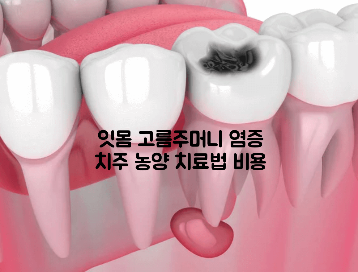 잇몸 고름주머니 염증 치주 농양 치료법 비용