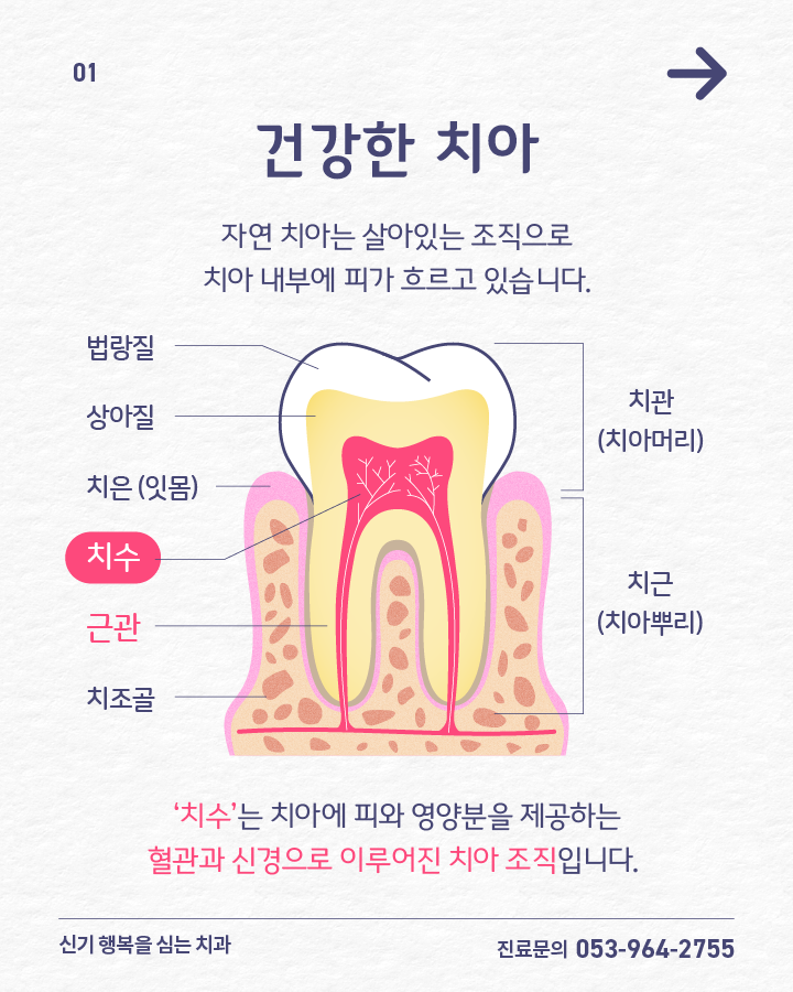 치아 신경치료란 이빨 신경치료 안하면 어떻게 되나요 신기행복을심는치과 건강정보
