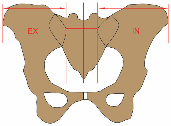카이로프락틱 리스팅(Chiropratic listing) 방법 :: EX / IN Ilium — 쉘든's 지식방