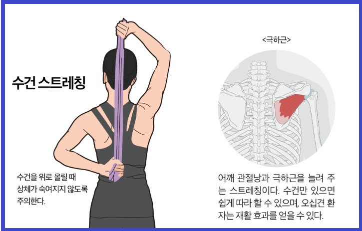 견갑골 통증 원인과 치료법 스트레칭까지 한눈에