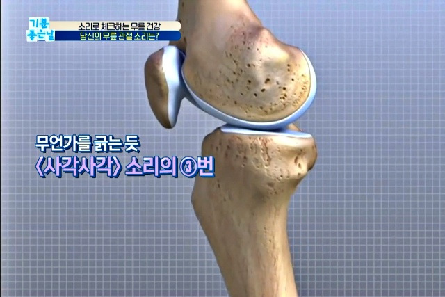 건강한 무릎에서 나는 소리 따로 있다 무릎에서 뚝뚝 소리나는 이유