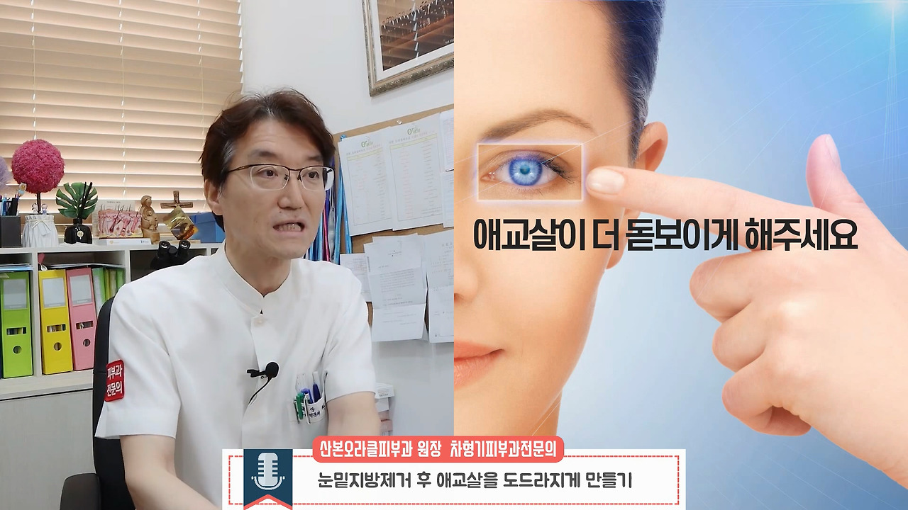 레이저눈밑지방제거 시 필러로 보완하면 애교살 만들 수 있습니다 산본오라클피부과