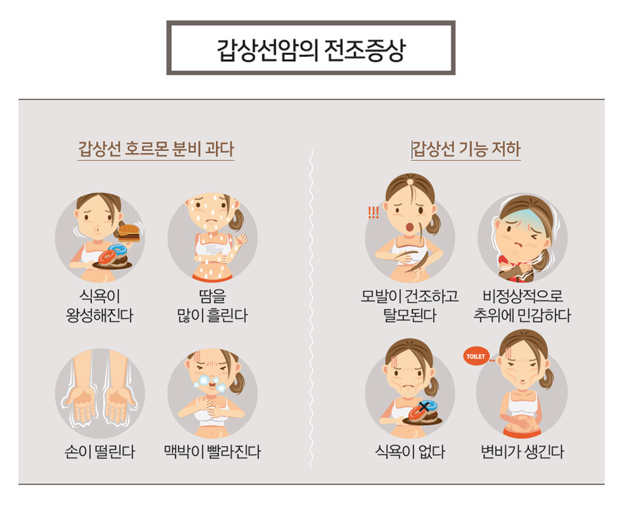 갑상선암 원인 및 증상 알아보기