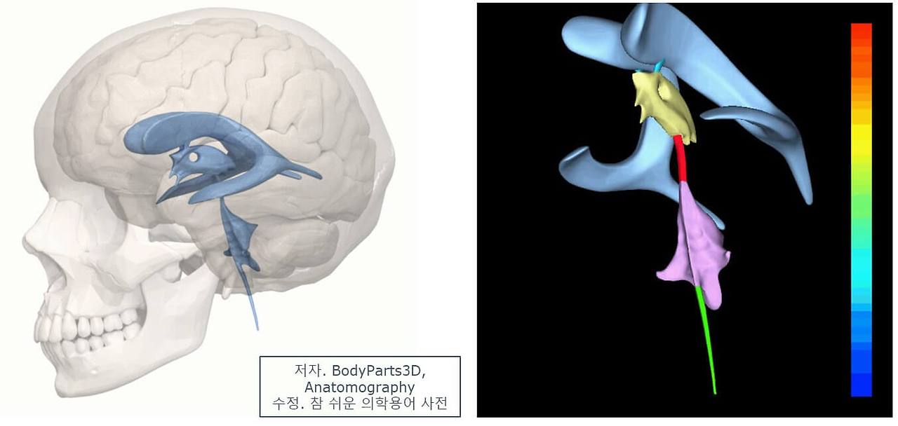 의학용어 Ventricle 뜻 실 뇌실 심실 후두실 종말뇌실