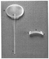 방수유출장치 Glaucoma Drainage Device / Implant, GDD, GDI 종류, Krupin, Ex ...