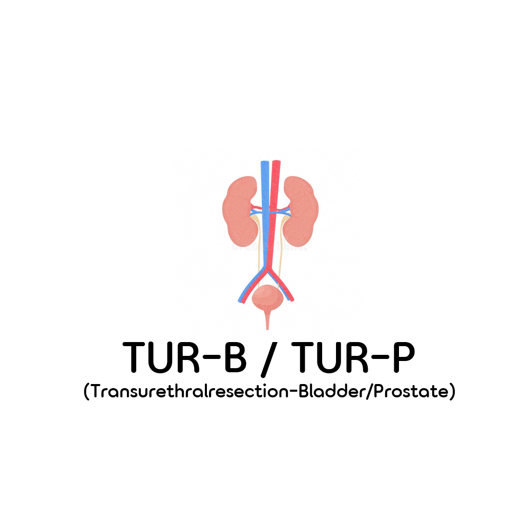 URO / TUR-B, TUR-P (Transurethralresection bladder, Prostate) 경요도 방광 ...
