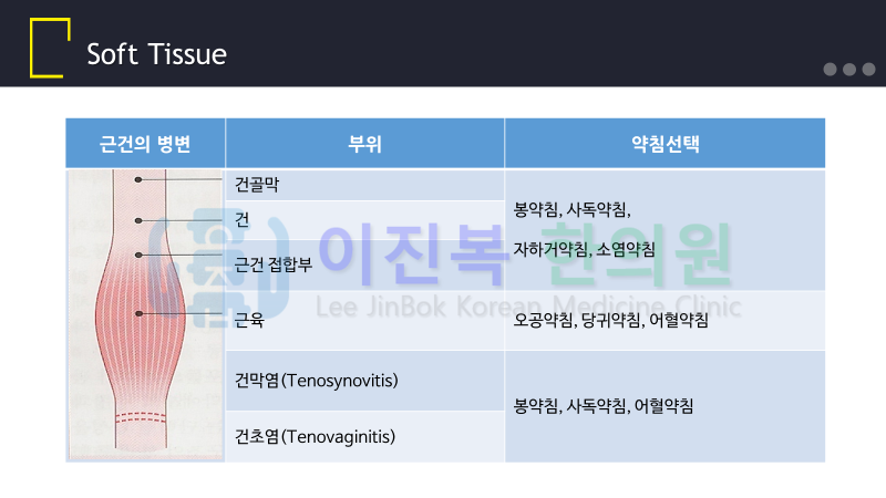 전주 이진복한의원 무릎 관절의 해부학적 구조