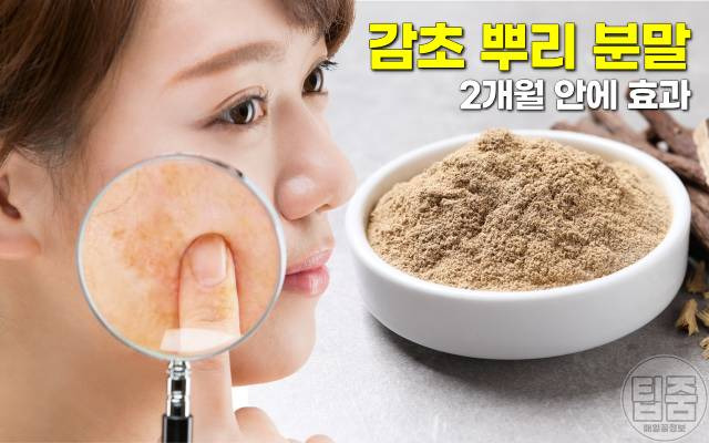 검버섯 제거 방법 5가지 피부과 의사가 알려주는 검버섯제거연고 바르는팁