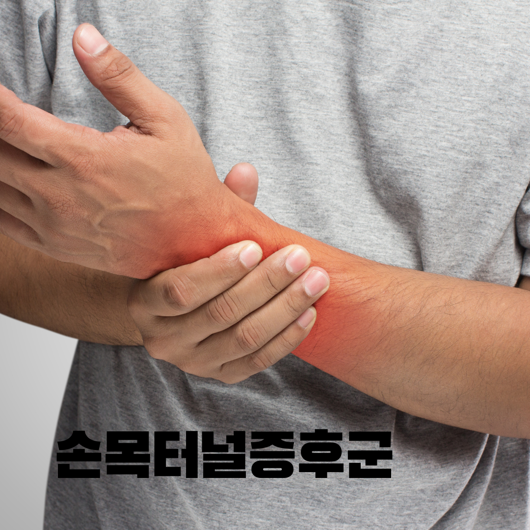 왜 연간 17만명이 병원을 찾을까 손목터널 증후군 증상과 극복방법
