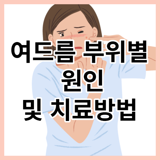 여드름 부위별 원인 및 치료방법 건강하세요 행복하세요
