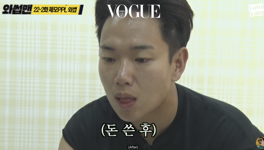 슈링크 부작용 볼패임 원상복귀 될까요? 시술 주기와 가격도 확인