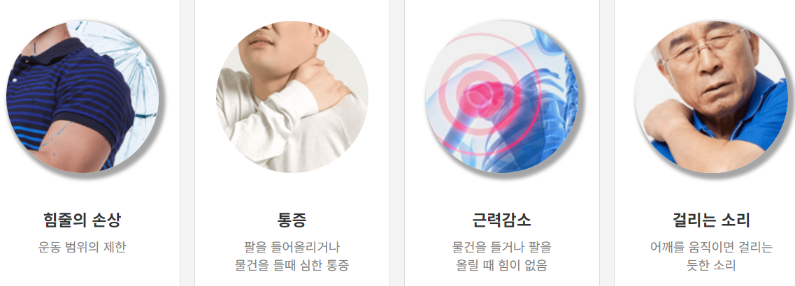 Ebs 명의 임태강 교수 어깨통증 오십견 회전근개 명의 알아보기 서울인포스트