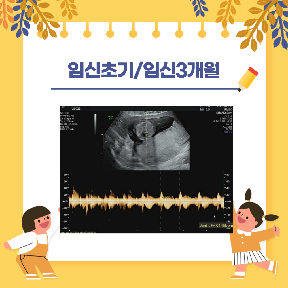 임신초기임신3개월9~12주 감정기복 정밀초음파