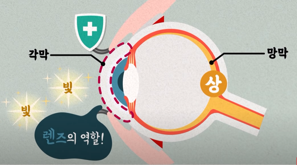 시력 나빠지는 원인과 좋아지는 눈 운동법