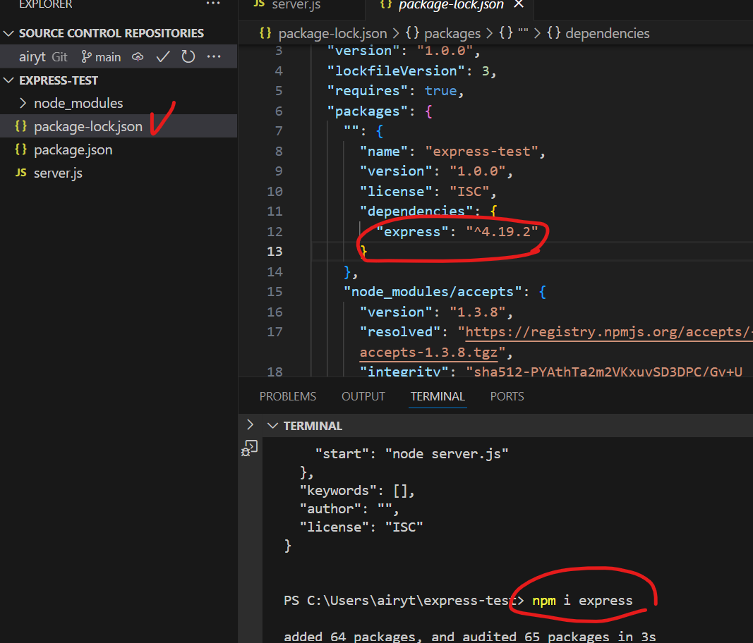 [Node.js] Request 객체의 IP Address 확인