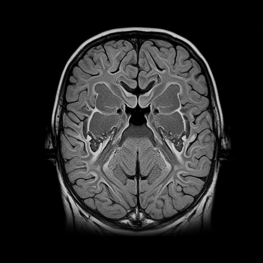 MRI와 MRA의 차이 (MRA와 MRI의 차이점)
