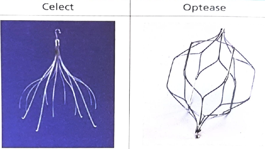 심부정맥 혈전증 치료 관리 방법