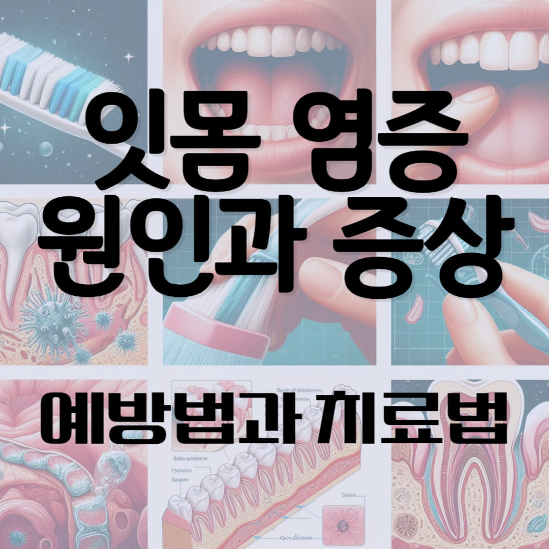 잇몸 염증 원인과 증상 그리고 예방법과 치료법