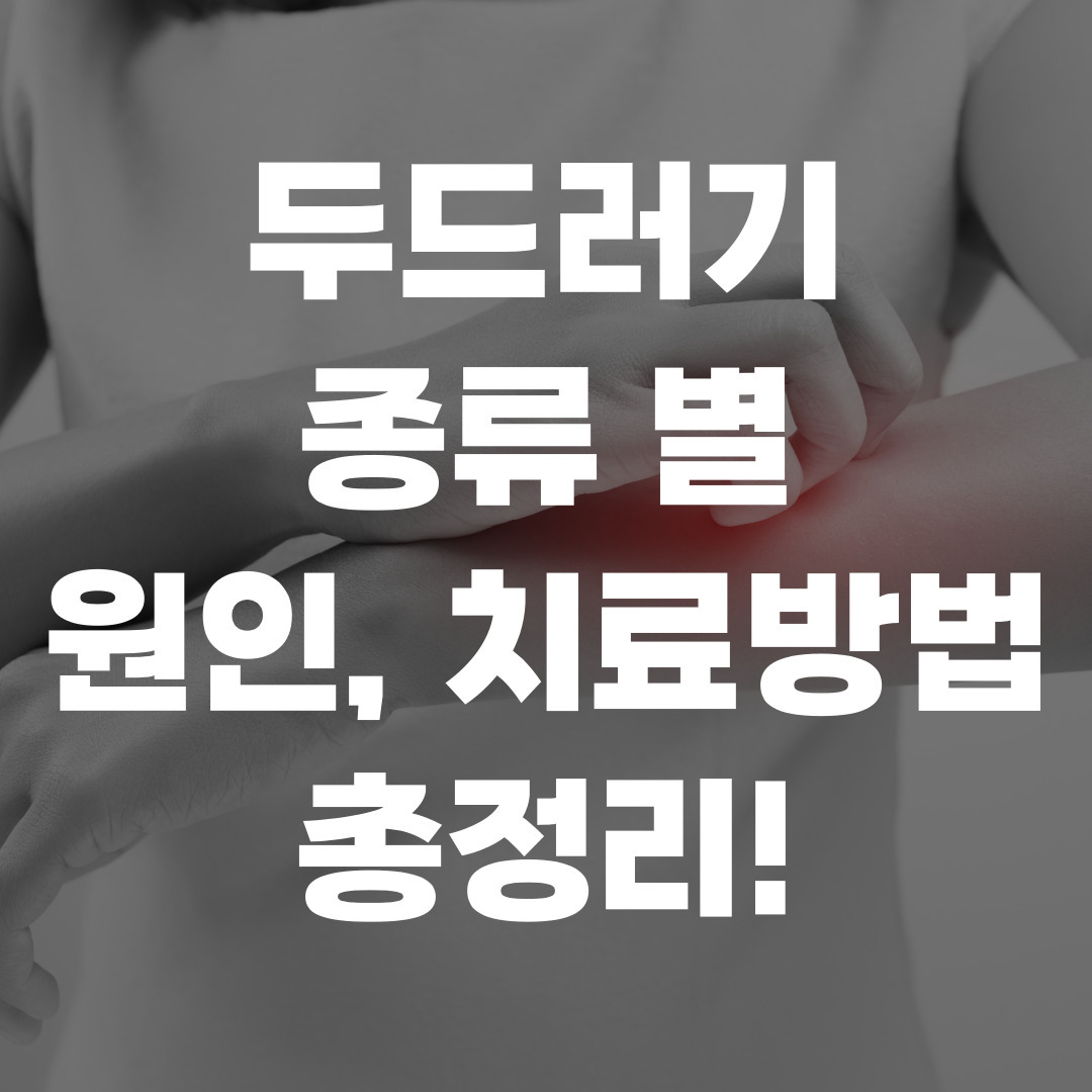 두드러기 종류 별 원인 치료방법 총정리