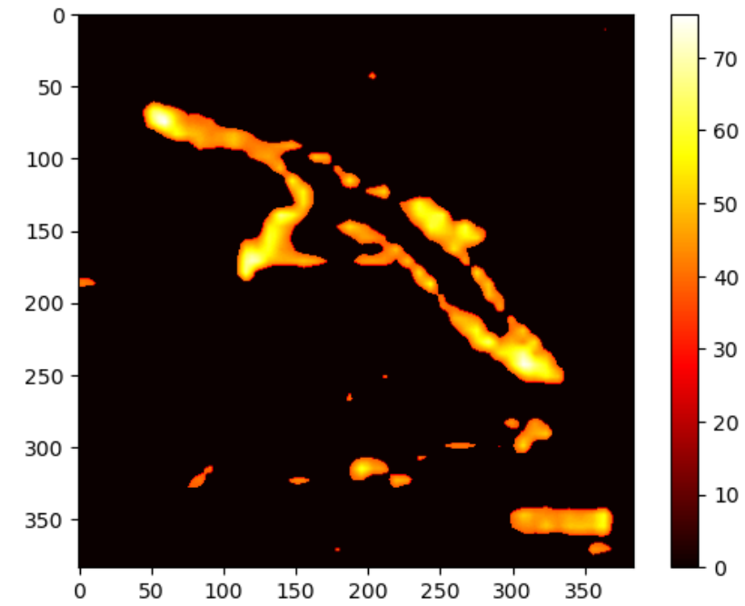 에러 ) The kernel appears to have died. It will restart automatically.